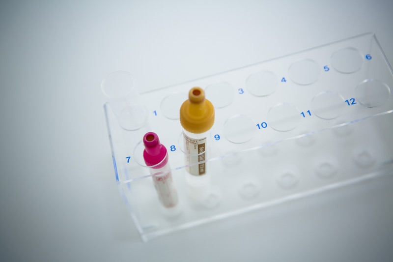 Prevencio Using AI to Detect Peripheral Artery Disease with Simple ...